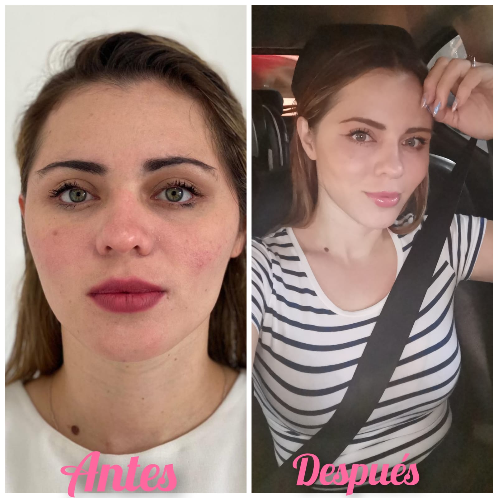 Corpo Cell SPA | Tratamientos