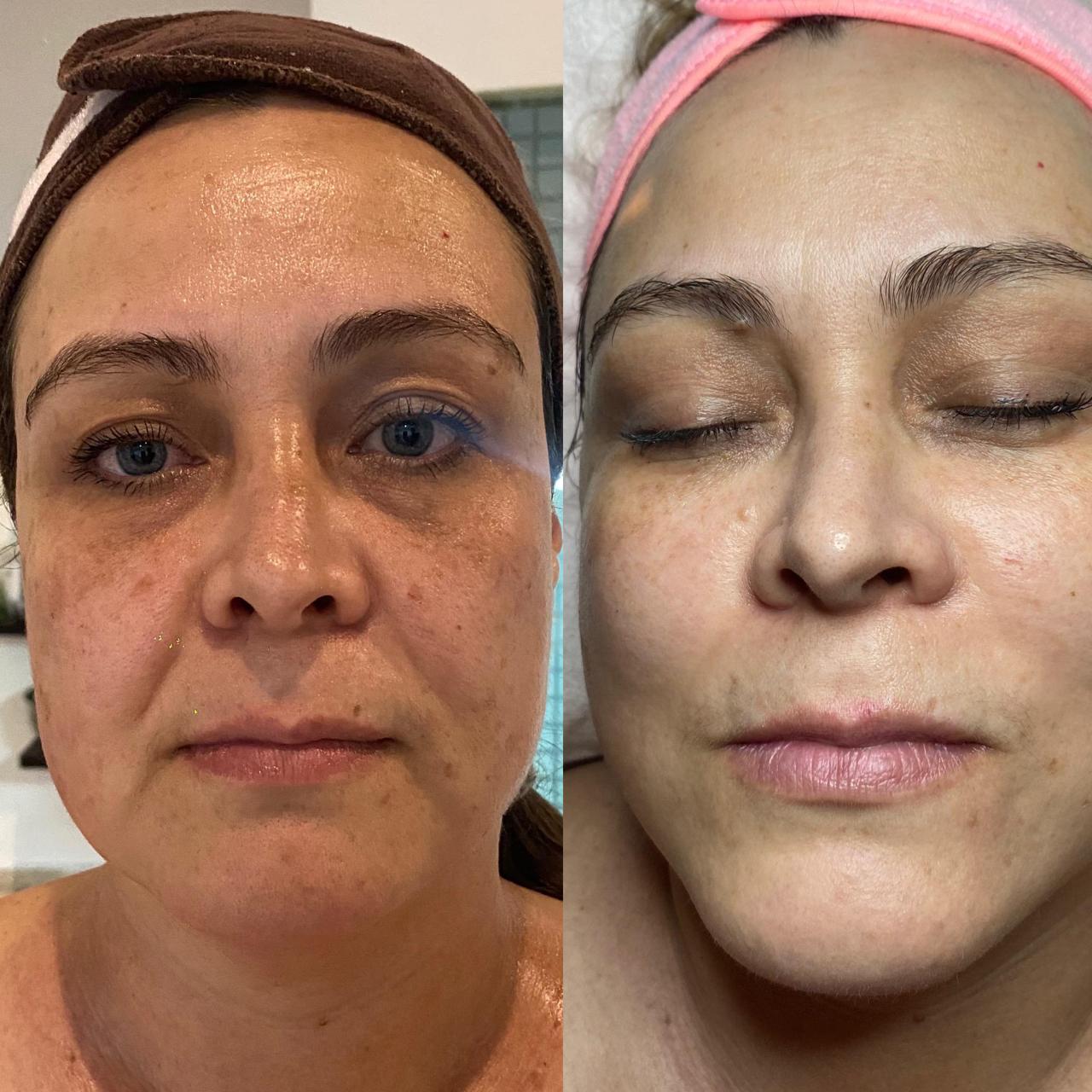 Corpo Cell SPA | Tratamientos