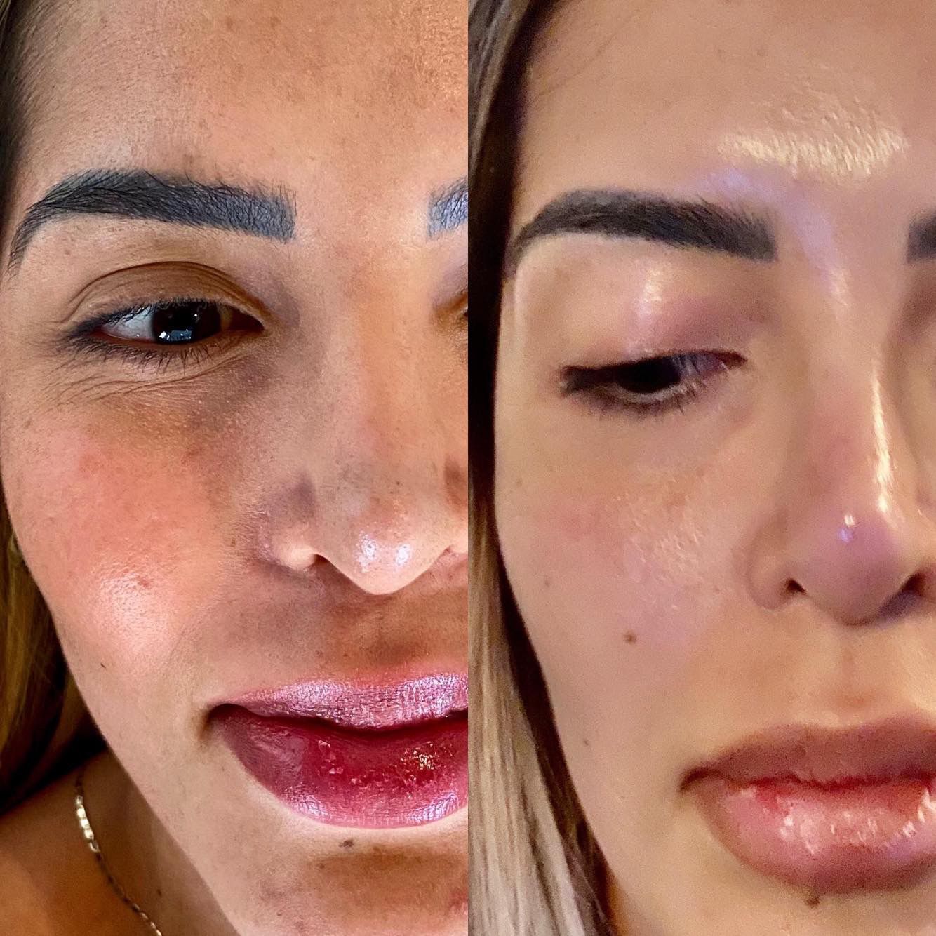 Corpo Cell SPA | Tratamientos